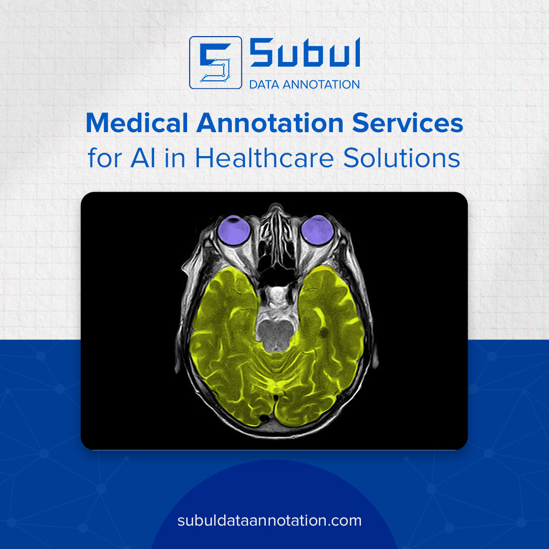 Medical Annotation Services for AI in Healthcare Solutions